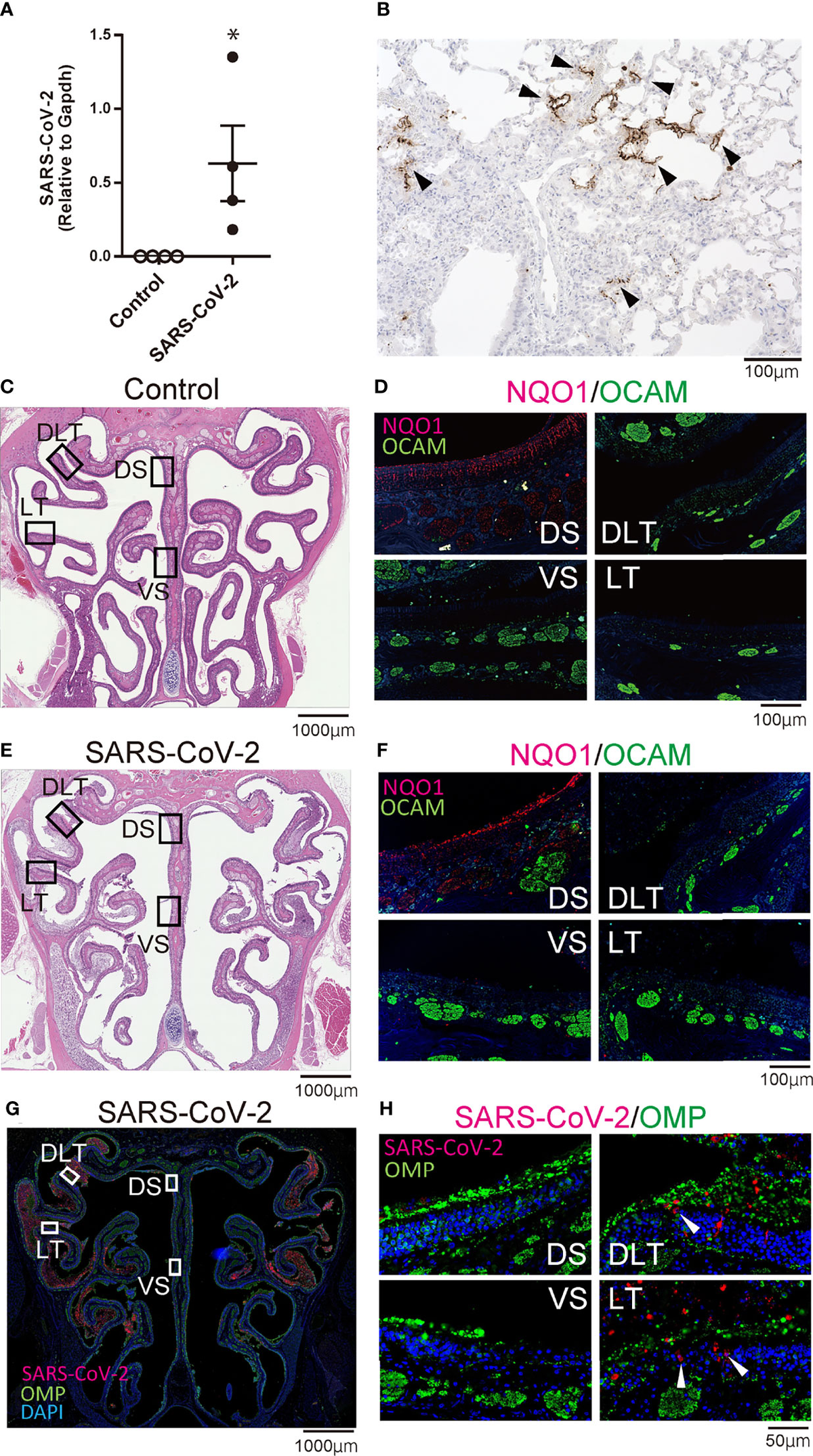 Frontiers | Oral SARS-CoV-2 Inoculation Causes Nasal Viral Infection ...