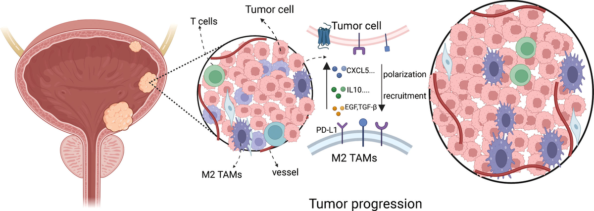 Frontiers | Identification of a six-gene prognostic signature for bladder cancer associated ...