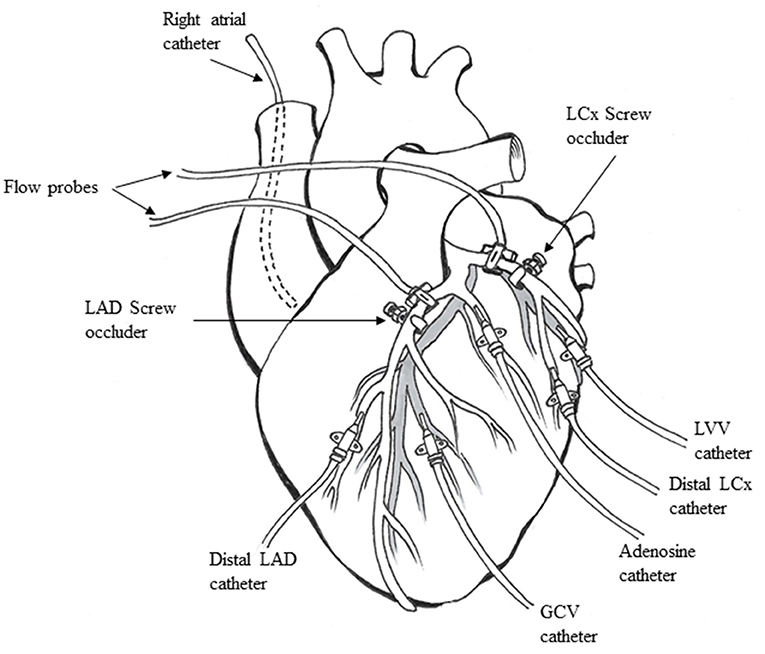 Frontiers | Persistent Coronary Vasomotor Tone During Myocardial ...