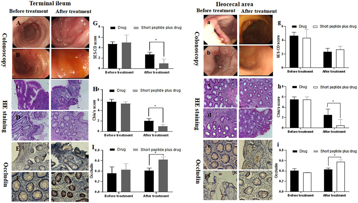 Frontiers | Efficacy of short-chain polypeptide-based EEN formulas in ...