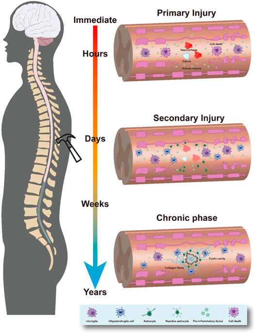 Frontiers | Hydrogels in Spinal Cord Injury Repair: A Review