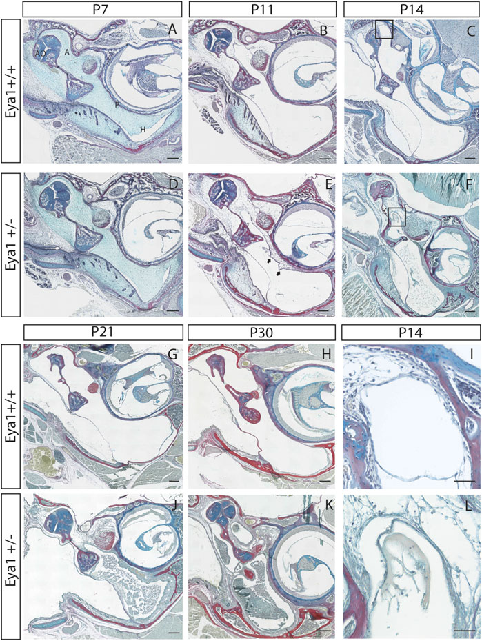 Frontiers | The interconnected relationships between middle ear bulla ...