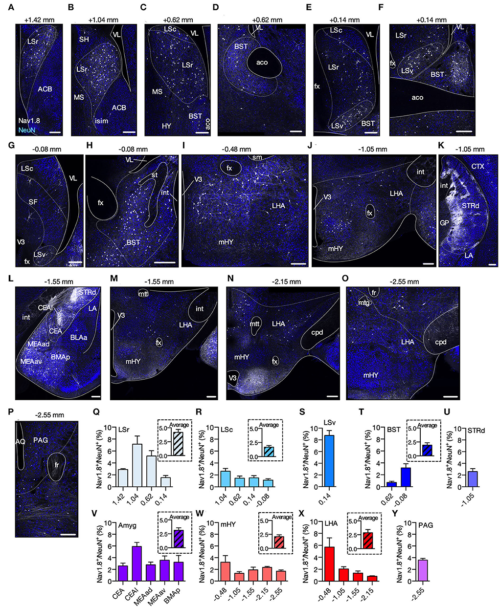 Frontiers | Transiently Nav1.8-expressing neurons are capable of ...