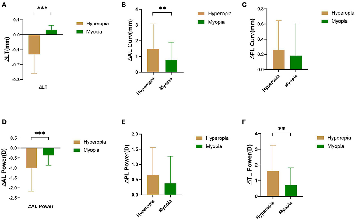 Frontiers | Comparison of lens refractive parameters in myopic and ...