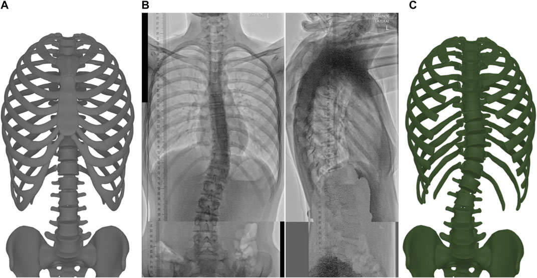 Frontiers | Biomechanical Morphing for Personalized Fitting of ...