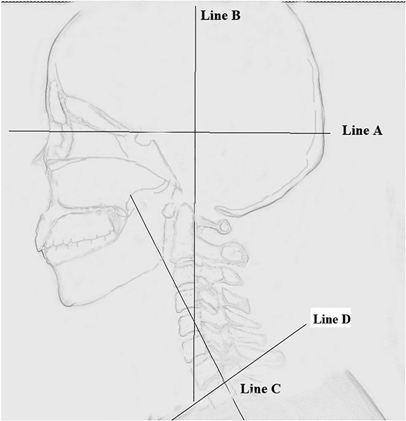 Frontiers | Establish a new parameter “horizontal view-axial angle” and ...
