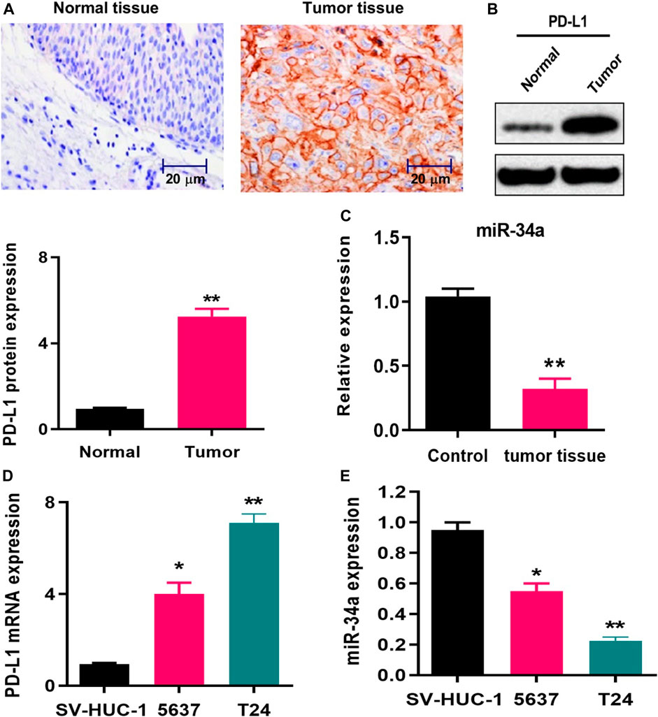 Frontiers | Multicomponent siRNA/miRNA-loaded modified mesoporous ...