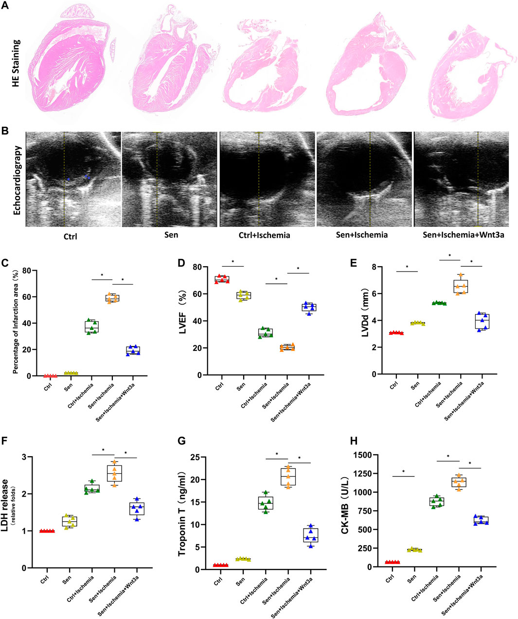 Frontiers | Wnt 3a Protects Myocardial Injury in Elderly Acute ...