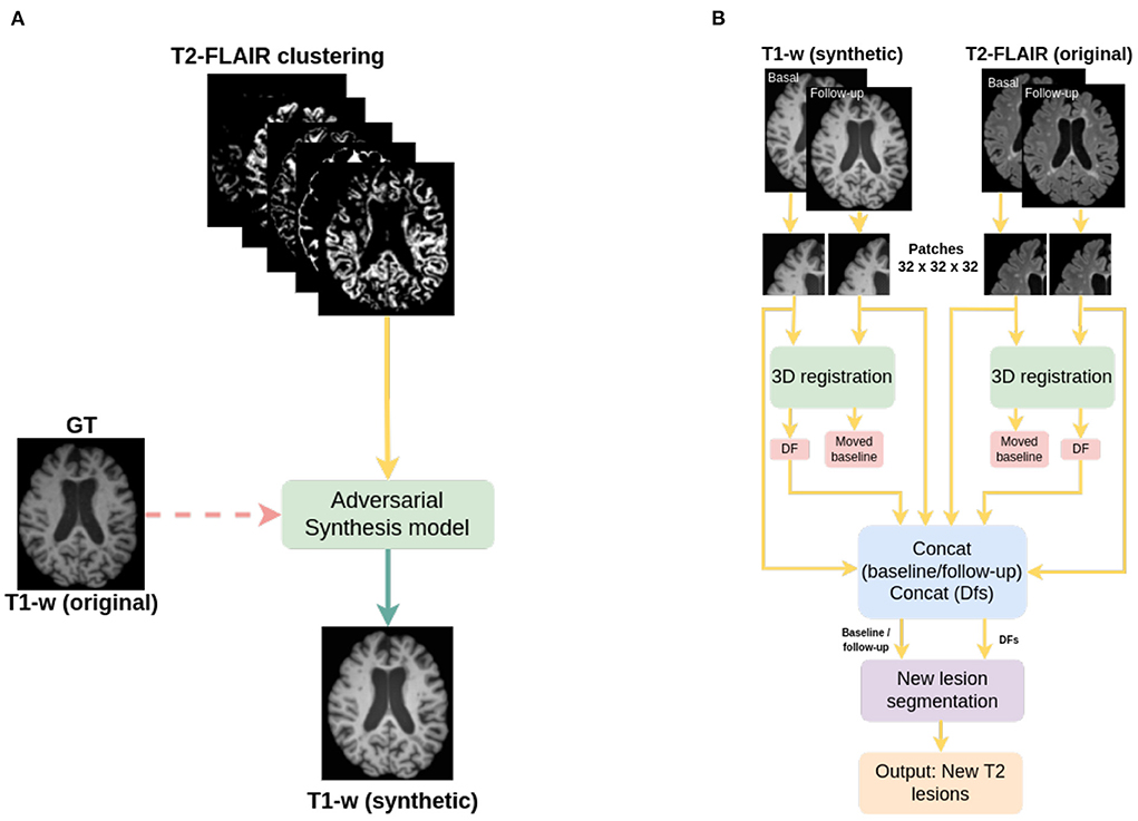 Frontiers | Evaluating the use of synthetic T1-w images in new T2 ...