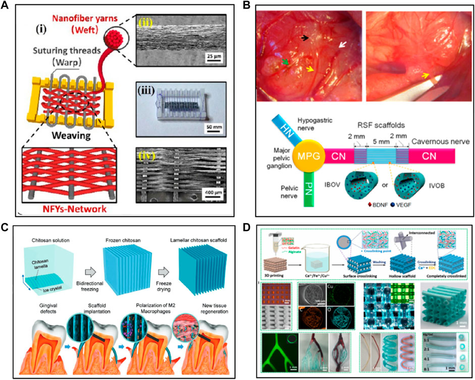 Frontiers | Natural polymer-based scaffolds for soft tissue repair