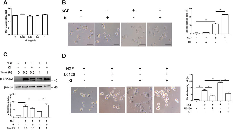 Frontiers | KI Essence extract (a spleen-tonifying formula) promotes ...