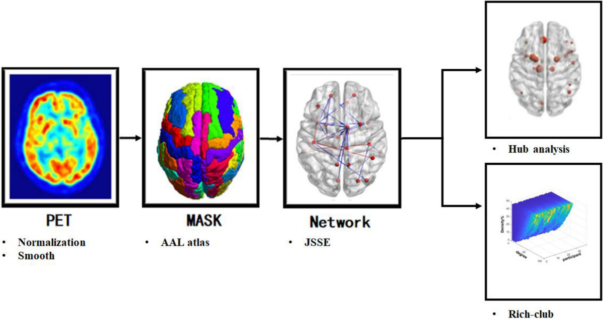 Frontiers | Alternation of the Rich-Club Organization of Individual ...