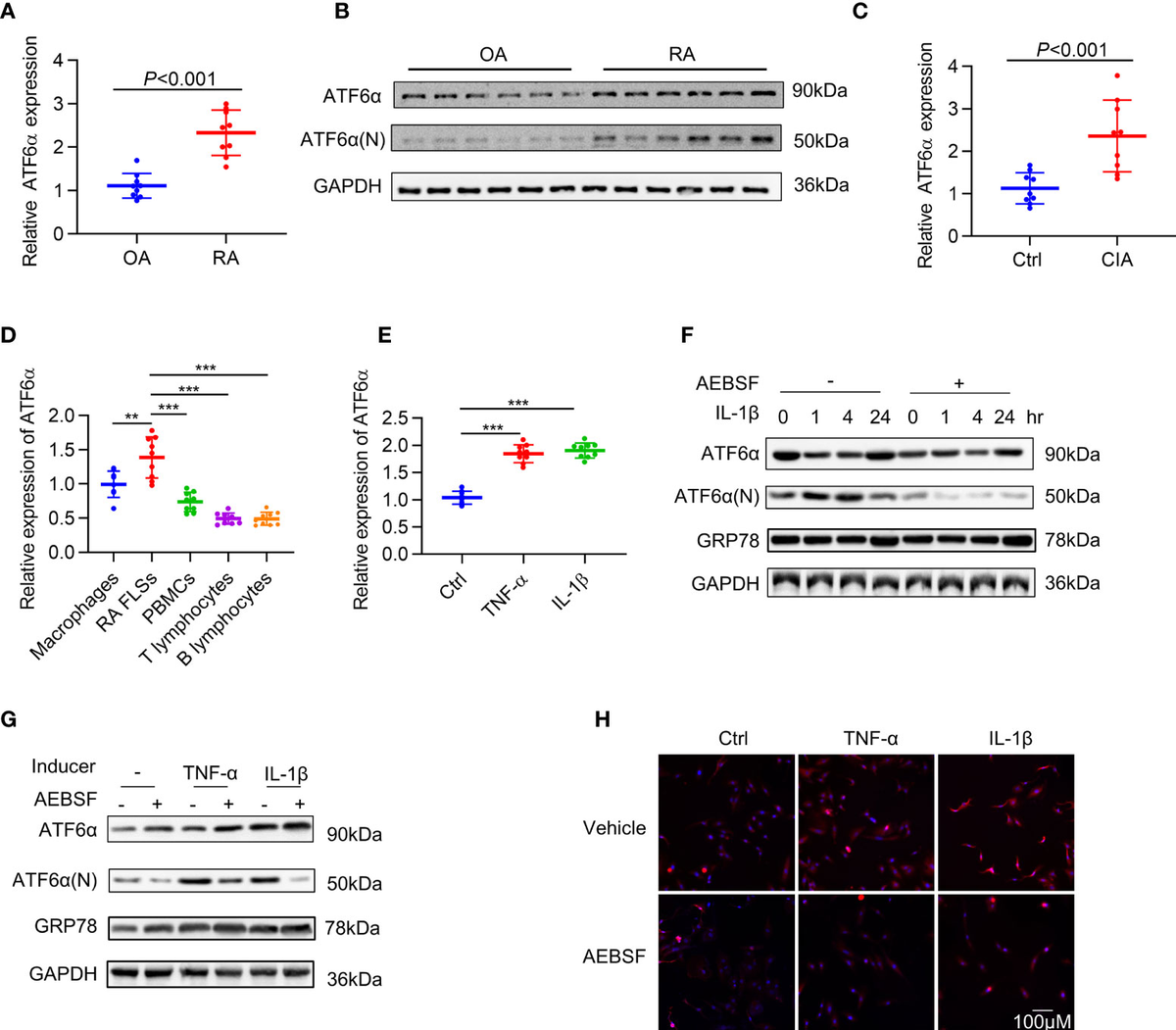 Frontiers | ATF6α contributes to rheumatoid arthritis by inducing ...