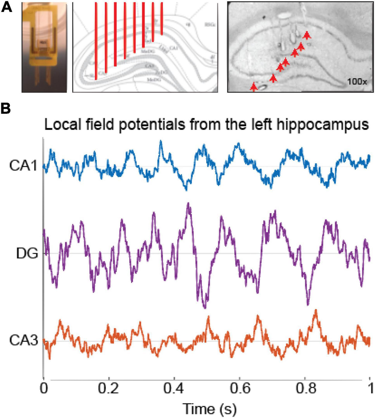 Frontiers | Theta and gamma oscillations in the rat hippocampus support ...