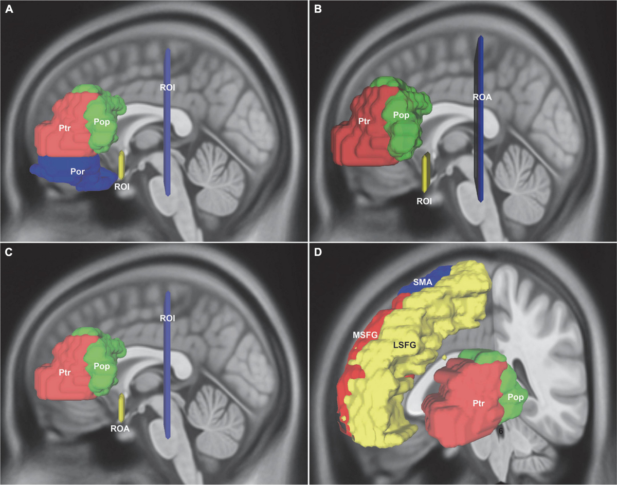 Frontiers | Association fiber tracts related to Broca’s area: A ...