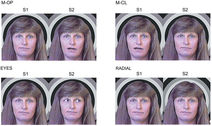 Frontiers | Magnetoencephalographic study on facial movements