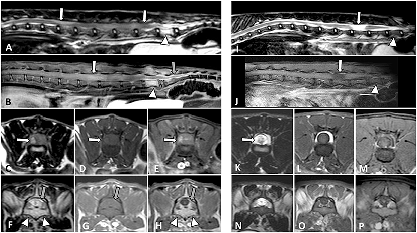 Frontiers | Clinical and magnetic resonance imaging features, and ...