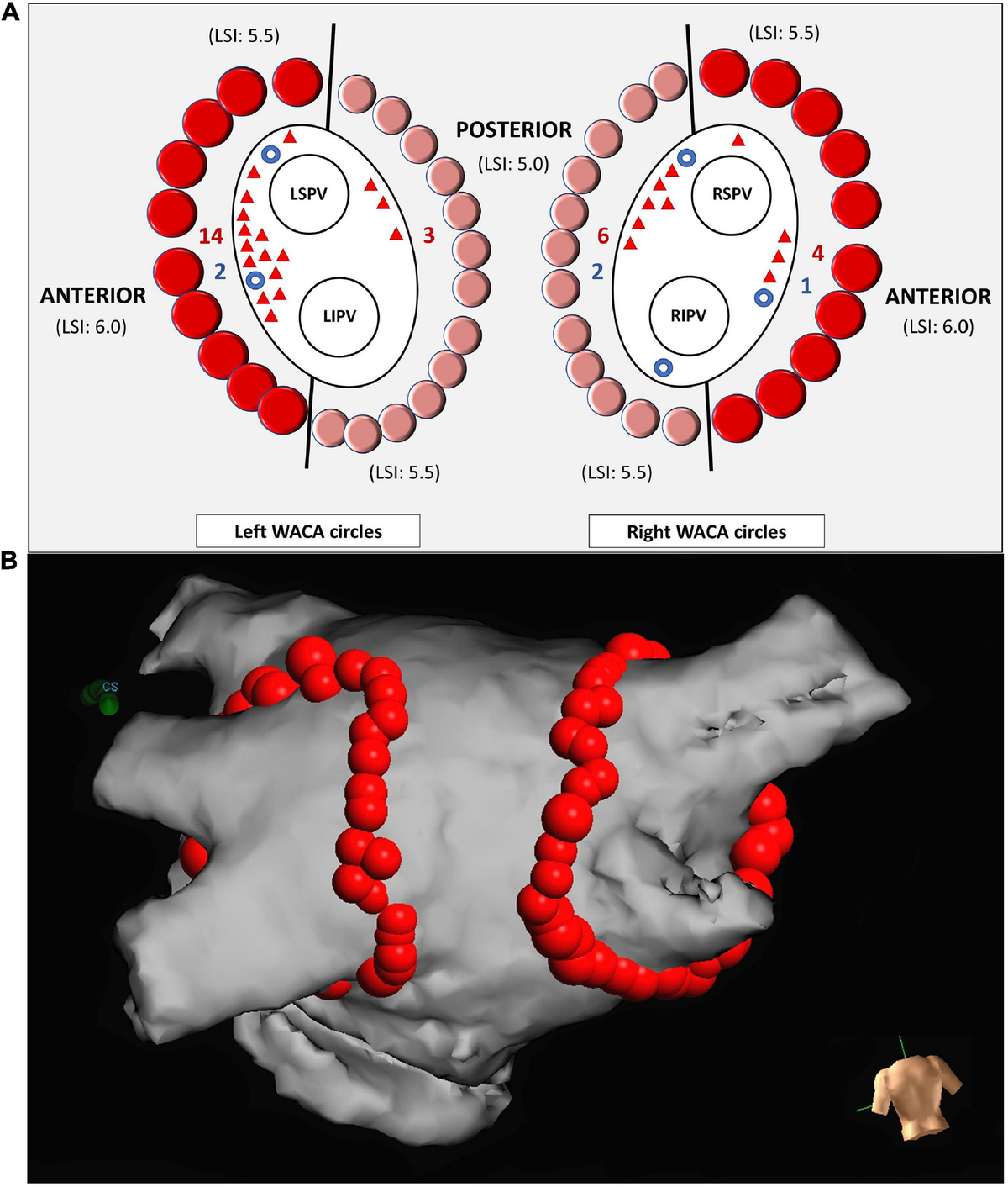 Frontiers | Risk factors for late reconnections after circumferential ...