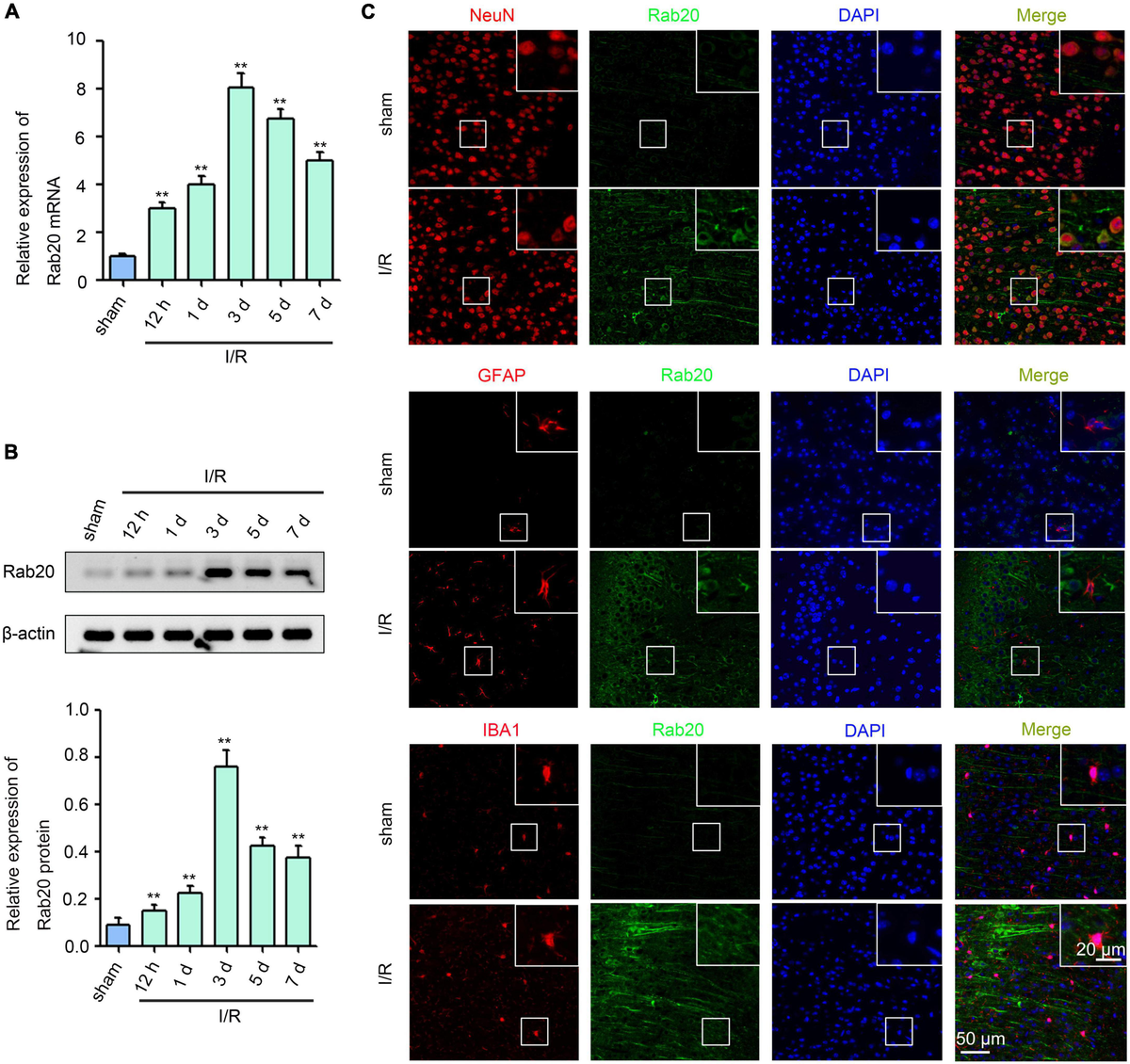 Frontiers | Ras-related protein Rab-20 inhibition alleviates cerebral ...