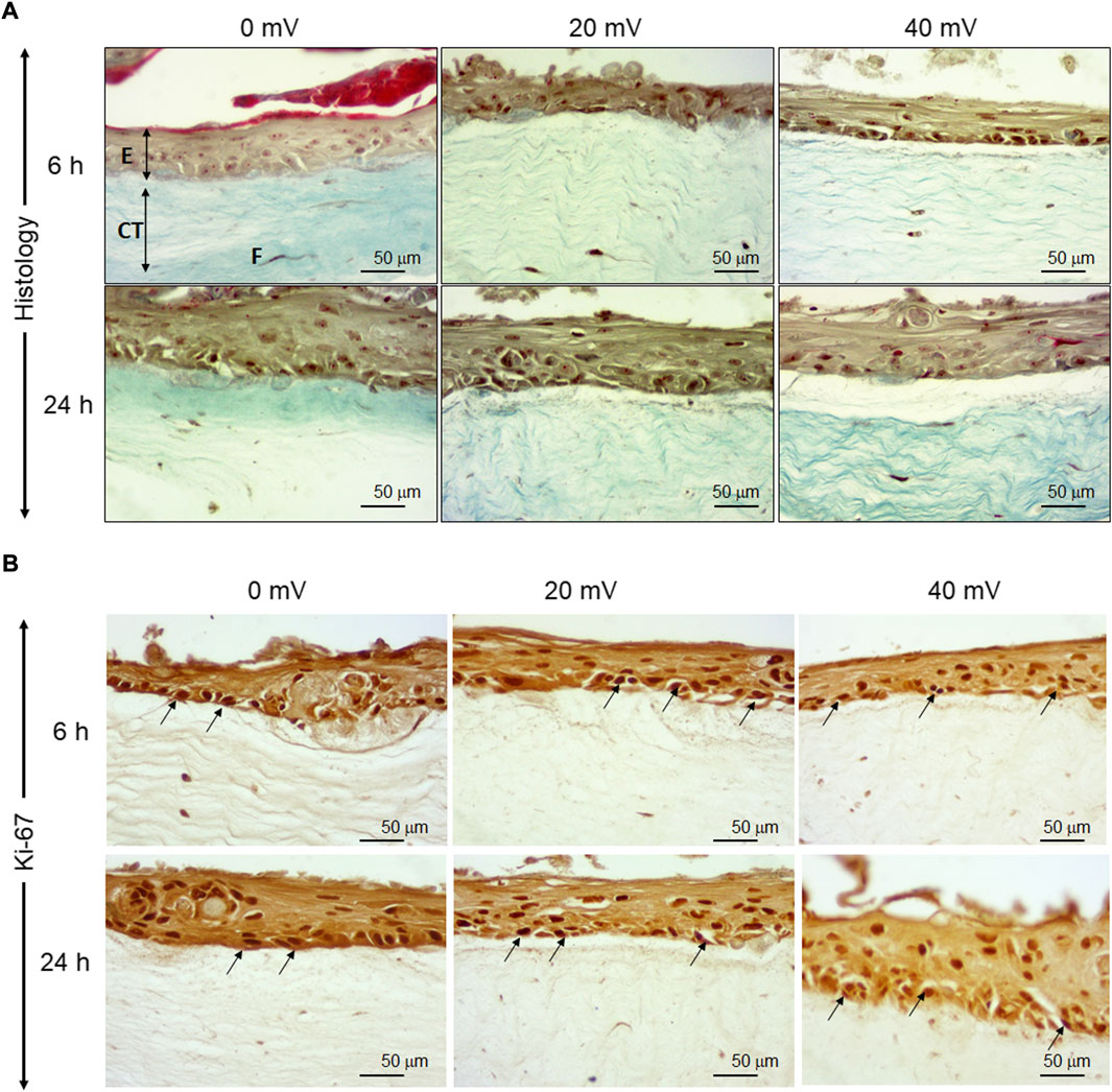 Frontiers | Engineering diabetic human skin equivalent for in vitro and ...