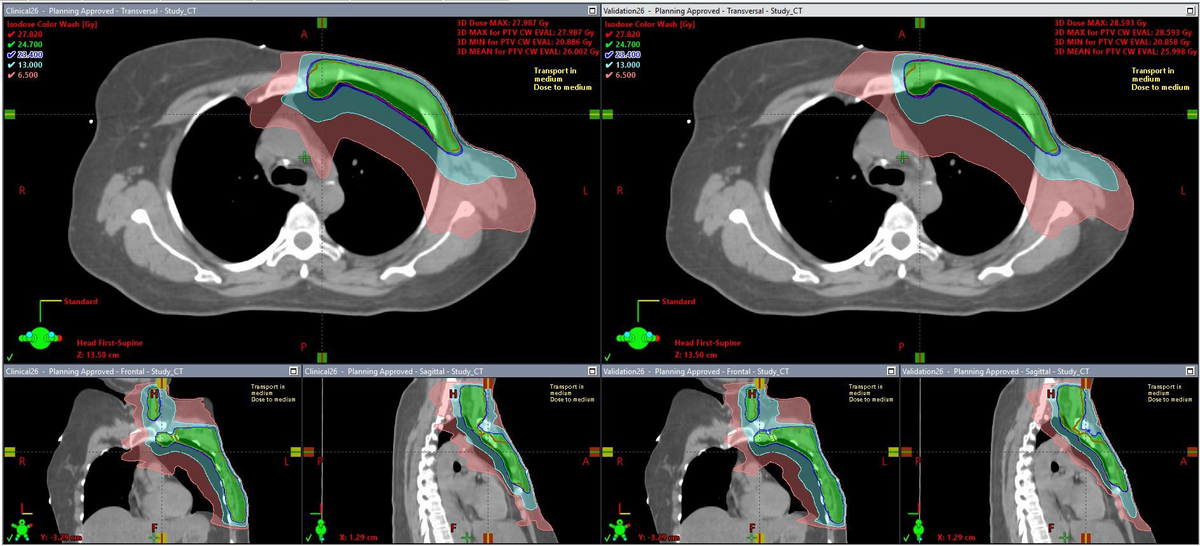 Frontiers | Can knowledge based treatment planning of VMAT for post ...