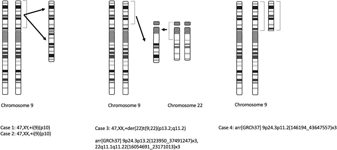 Frontiers | Cases of tetrasomy 9p and trisomy 9p in prenatal diagnosis ...