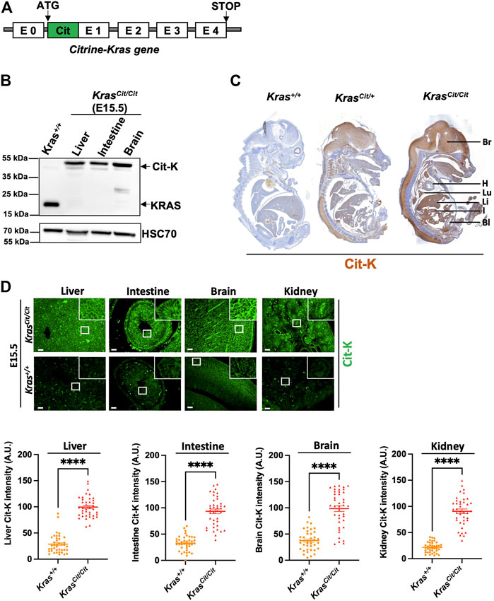 Frontiers | KRAS protein expression becomes progressively restricted ...
