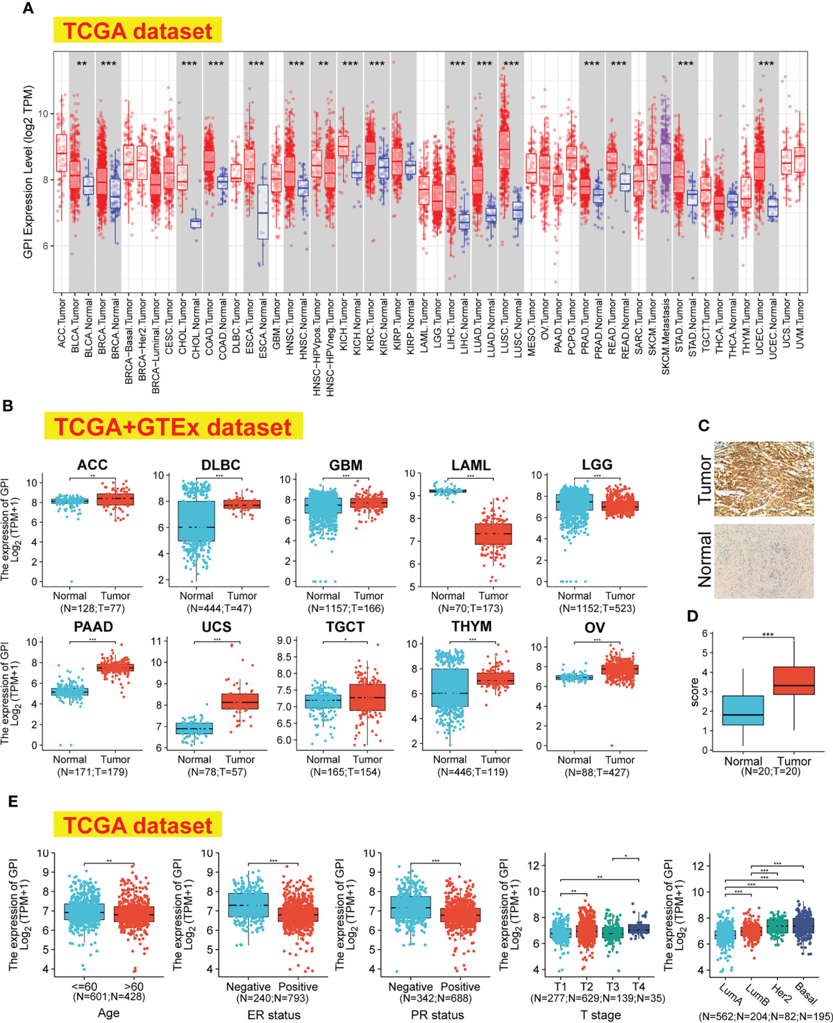 Frontiers | GPI: An indicator for immune infiltrates and prognosis of ...