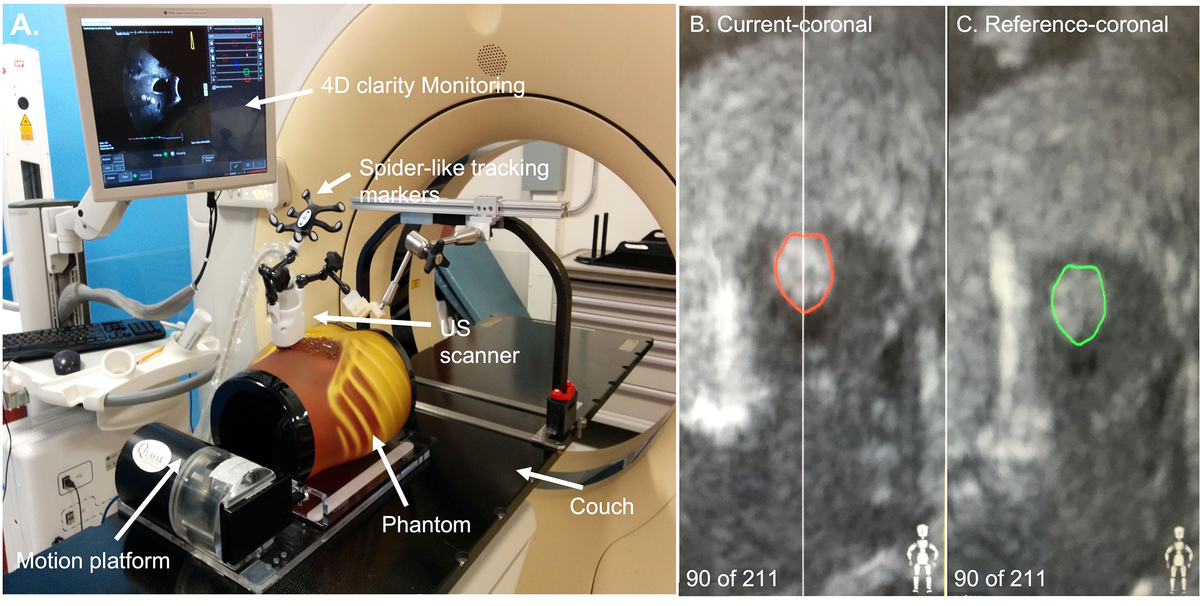 Frontiers | A phantom-based analysis for tracking intra-fraction ...