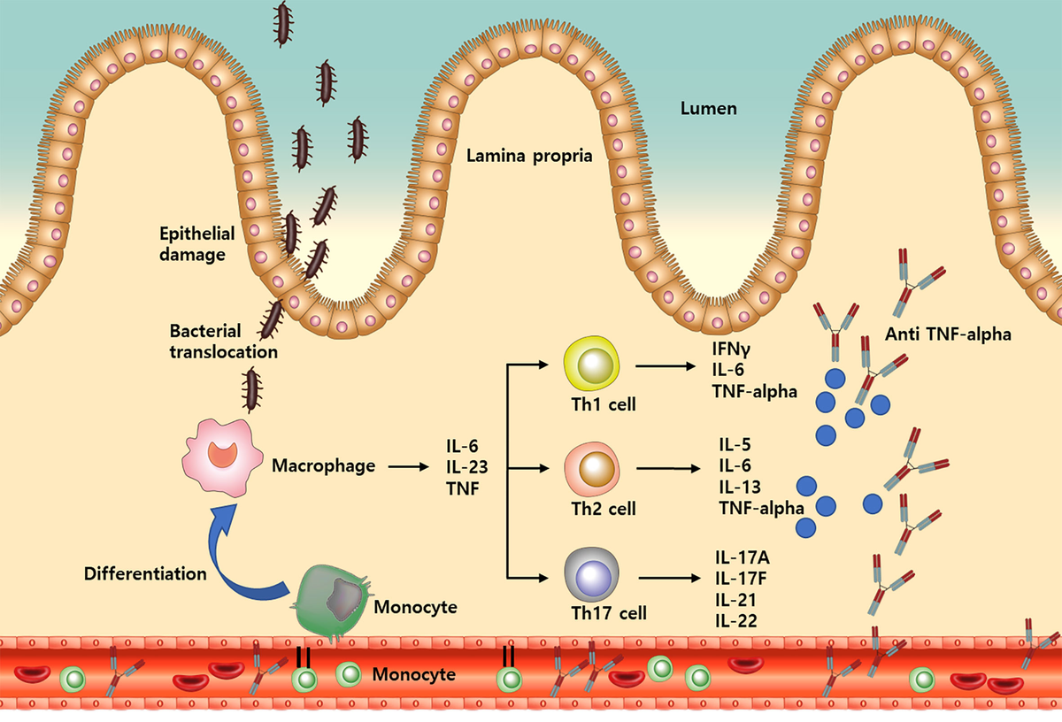 Frontiers | Increased monocyte abundance as a marker for relapse after ...
