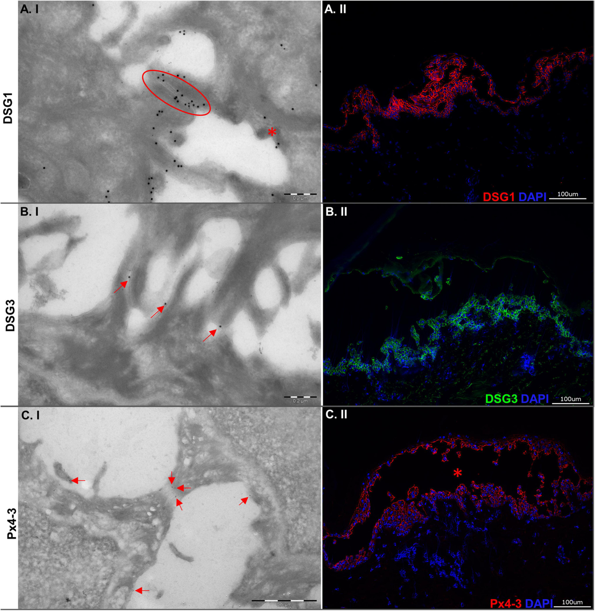 Frontiers | Electron microscopy of desmosomal structures in the ...