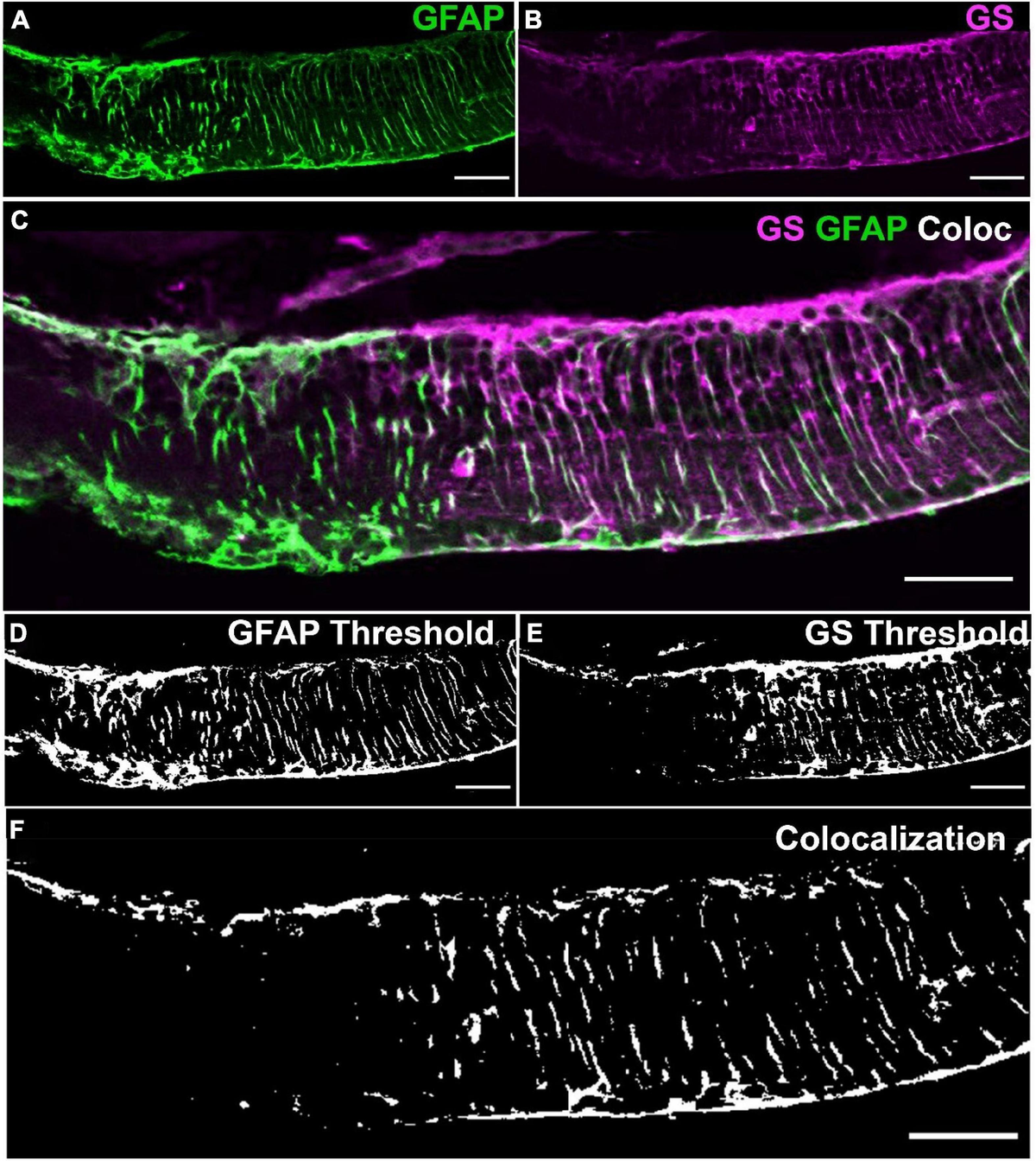 Frontiers | Loss of Müller cell glutamine synthetase immunoreactivity ...