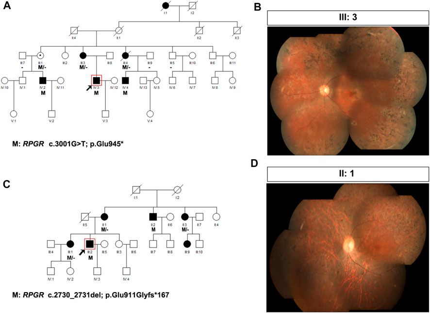 Frontiers | Analysis of RPGR gene mutations in 41 Chinese families ...