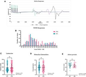 withdrawal reflex stimulus