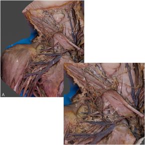 cadaveric material