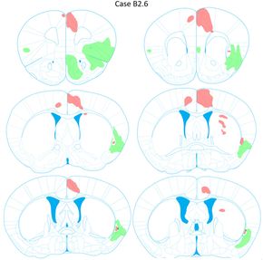 anterior cingulate cortex mouse