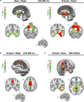 medial temporal lobe memory