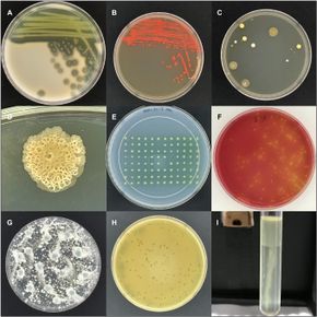 agar plates types