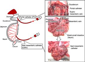 duodenum catheter