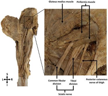 sciatic nerve roots origin