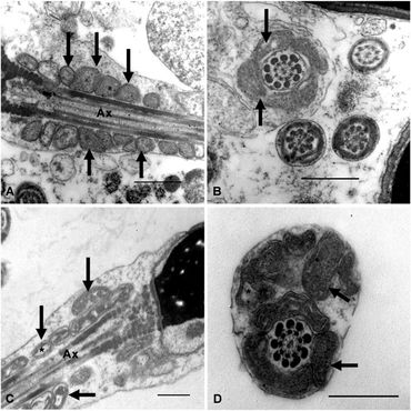 mitochondria sperm cell