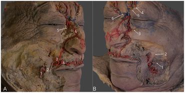 real human dissection