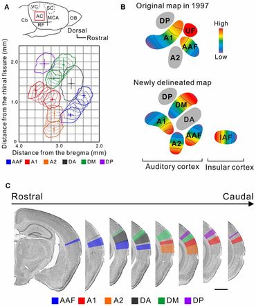 primary auditory cortex a1