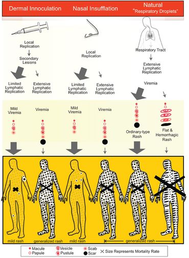 chinese smallpox inoculation