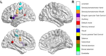 angular gyrus aphasia