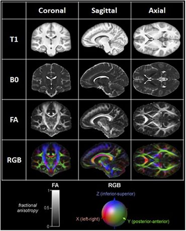 superior longitudinal fasciculus function
