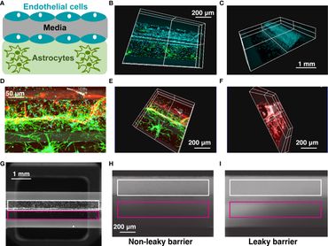 cranial plating cycle