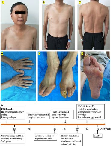 werner syndrome defect