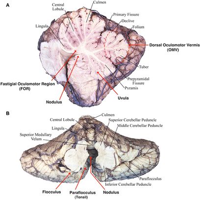 fastigial nucleus