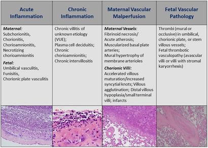 how long does placenta pathology take